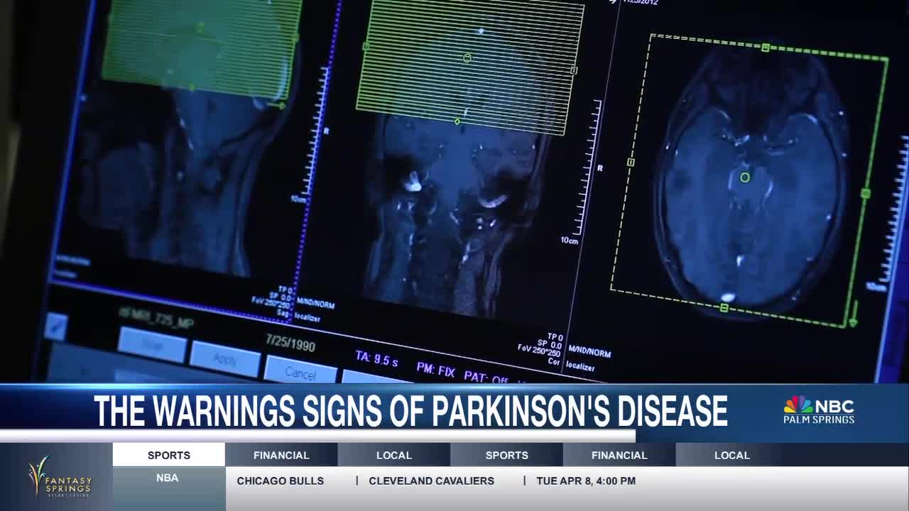 The Warning Signs Of Parkinson's Disease