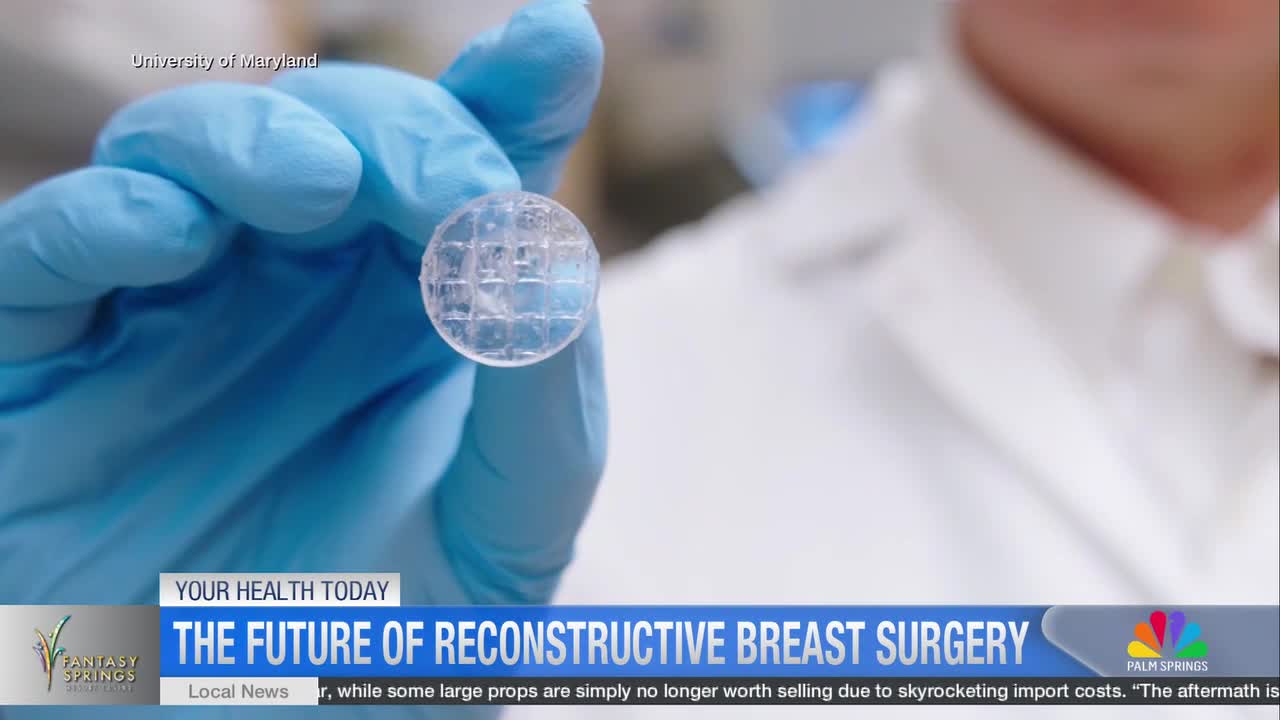 3D Printing Technology Offers Hope for Breast Cancer Survivors