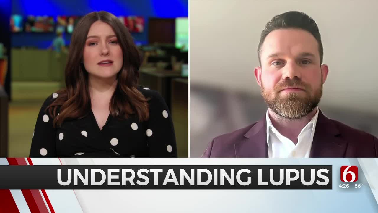 Doctor Explains Significance Of Lupus Discovery