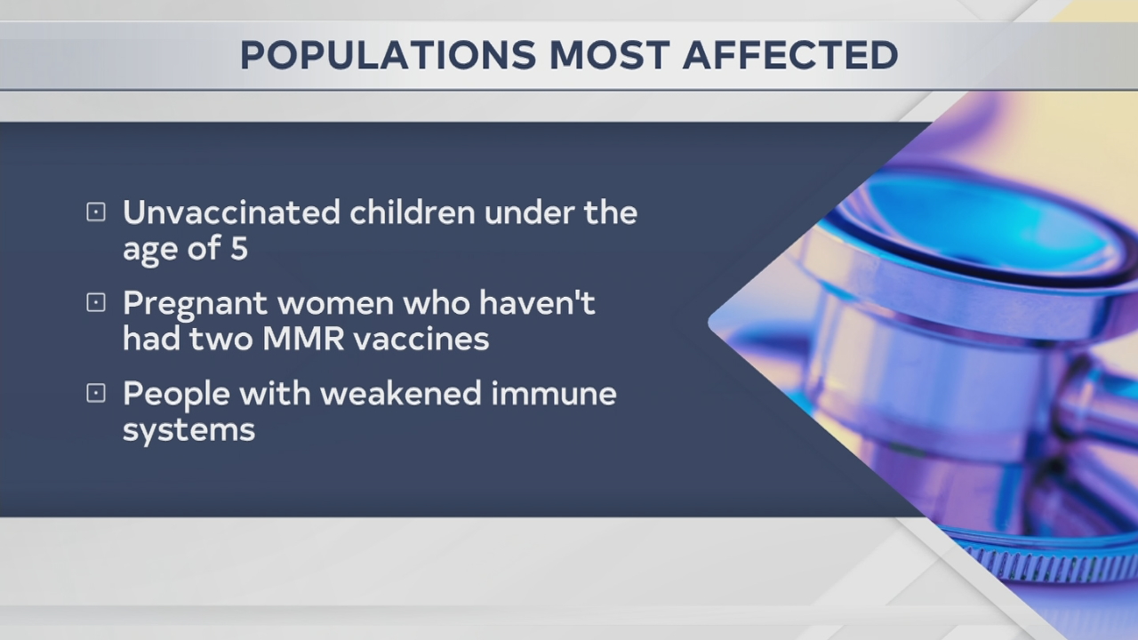 Who's At Risk? Pediatrician explains Measles risks, offers prevention tips