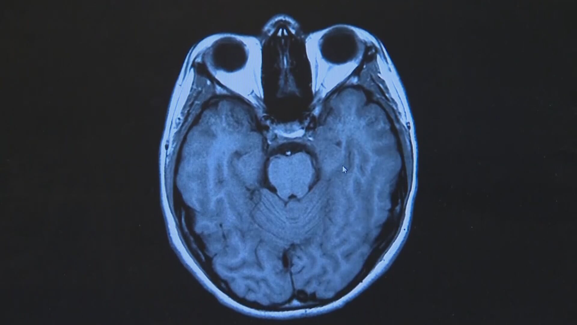 4 lifestyle strategies to protect brain health