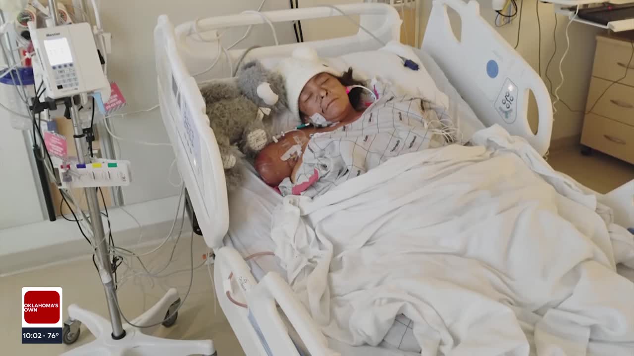 Woman attacked by dogs in Okmulgee loses all four limbs; police say one ...
